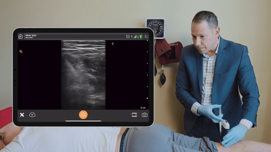 [WEBINAR] How to Perform an Ultrasound-Guided Cluneal Nerve ...