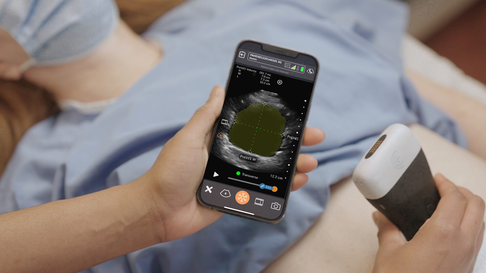 Bladder AI - Automated Bladder Volume Calculation | Clarius