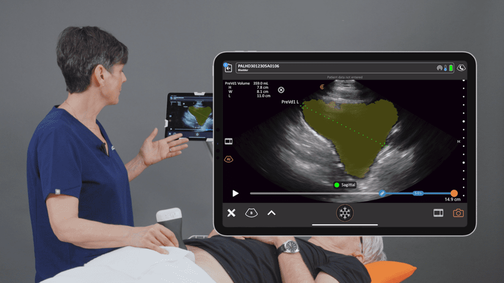 Clarius Bladder AI with the PAL Scanner | Clarius