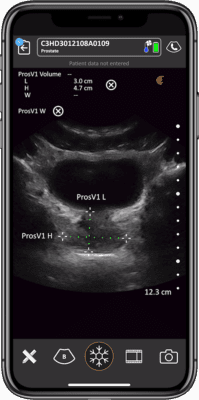 POCUS in Urology: 5 Ways to Streamline Patient Care | Clarius