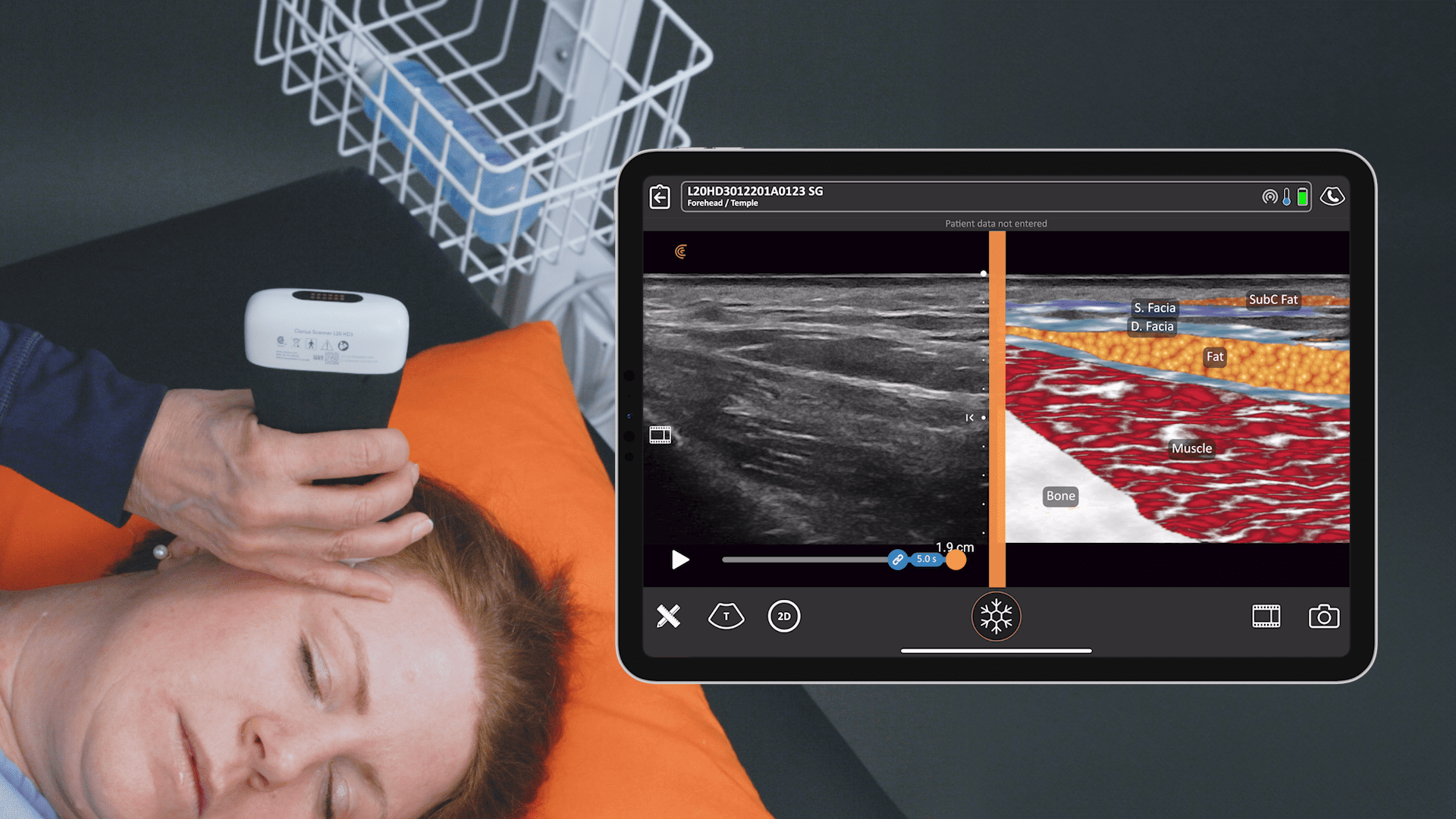 T-Mode™ for Facial Aesthetics | Clarius