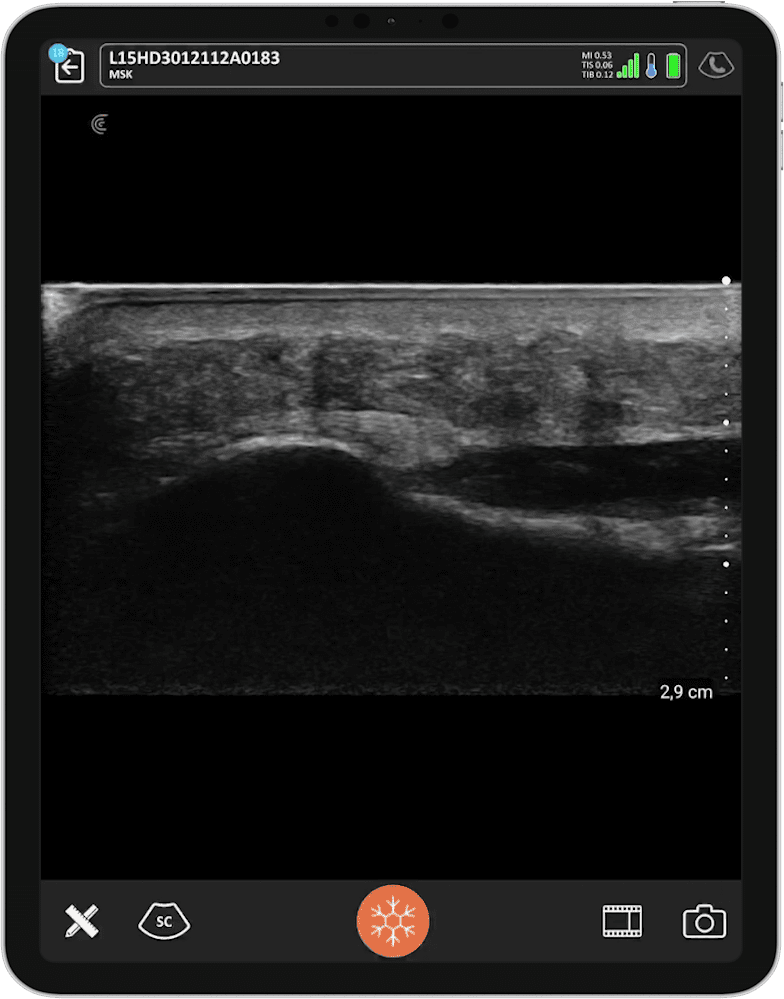 POCUS Essentials in Podiatry: Enhancing Foot and Ankle Assessments | Clarius