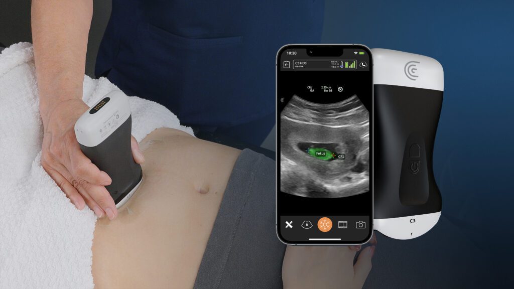 Clarius | Portable Pocket Handheld Ultrasound Scanners