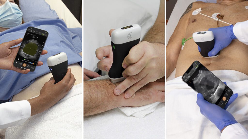 Clarius | Portable Pocket Handheld Ultrasound Scanners