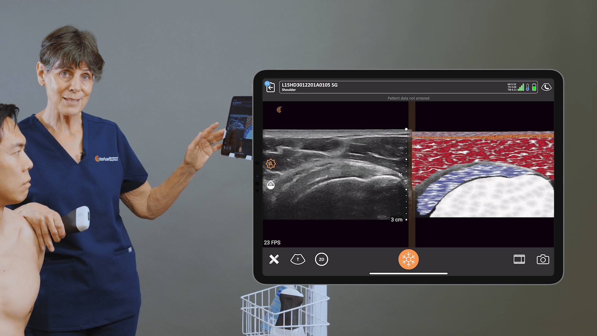 T-Mode™ for Shoulder | Clarius