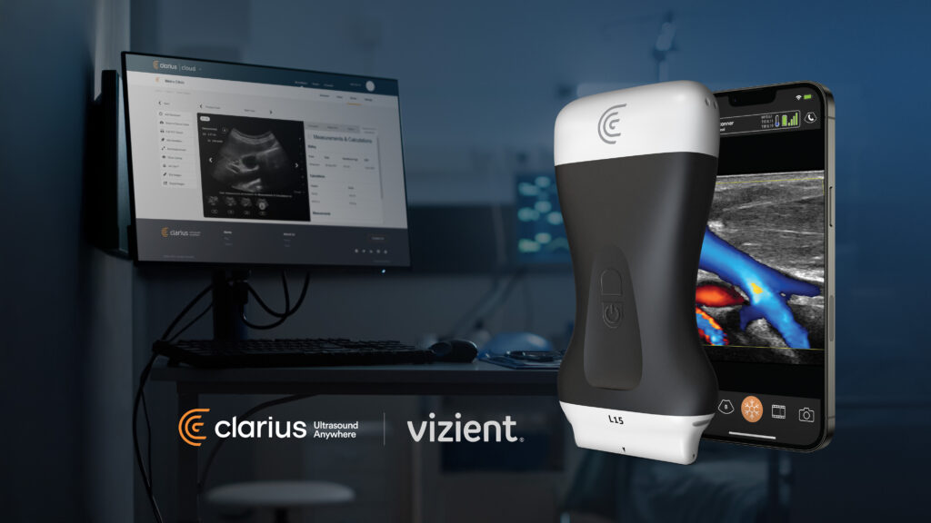 Clarius Selected to Exhibit Wireless Ultrasound Scanners at Vizient ...