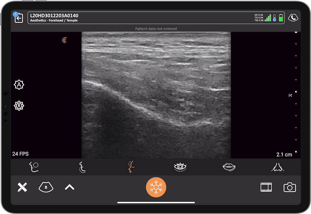 Ultrasound for Facial Aesthetics: A Beginner’s Guide to Scanning Like a ...