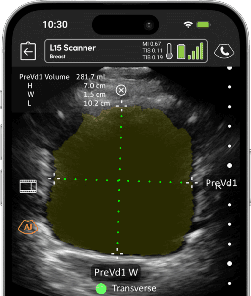 POCUS: Point of Care Ultrasound for Primary Care | Clarius