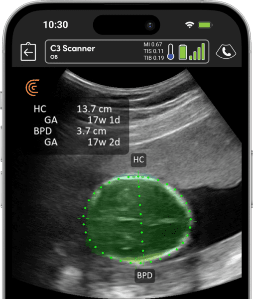 Women’s Health | Clarius