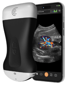 Clarius Mobile Health | Portable Handheld Ultrasound Systems