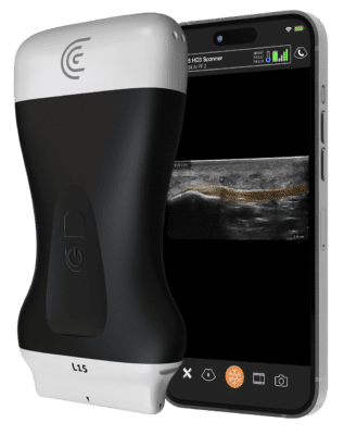 Clarius Mobile Health | Portable Handheld Ultrasound Systems