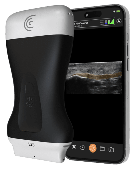 Clarius Mobile Health | Portable Handheld Ultrasound Systems