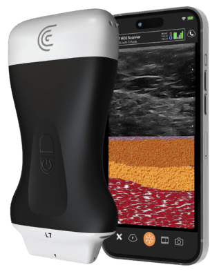 Clarius Mobile Health | Portable Handheld Ultrasound Systems