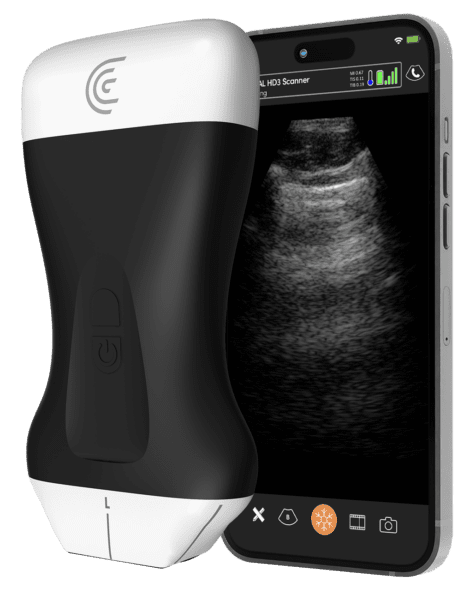 Clarius Mobile Health | Portable Handheld Ultrasound Systems