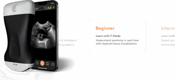 Clarius Mobile Health | Portable Handheld Ultrasound Systems