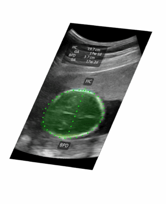 Clarius Mobile Health | Portable Handheld Ultrasound Systems