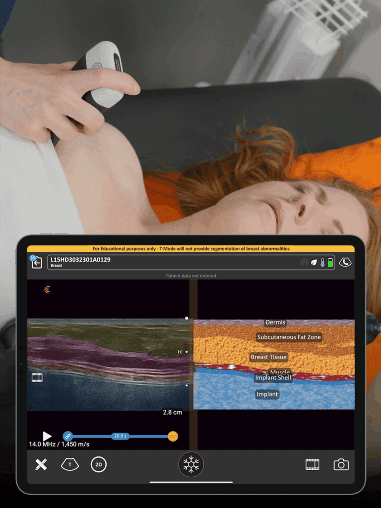 Plastic Surgery | Clarius