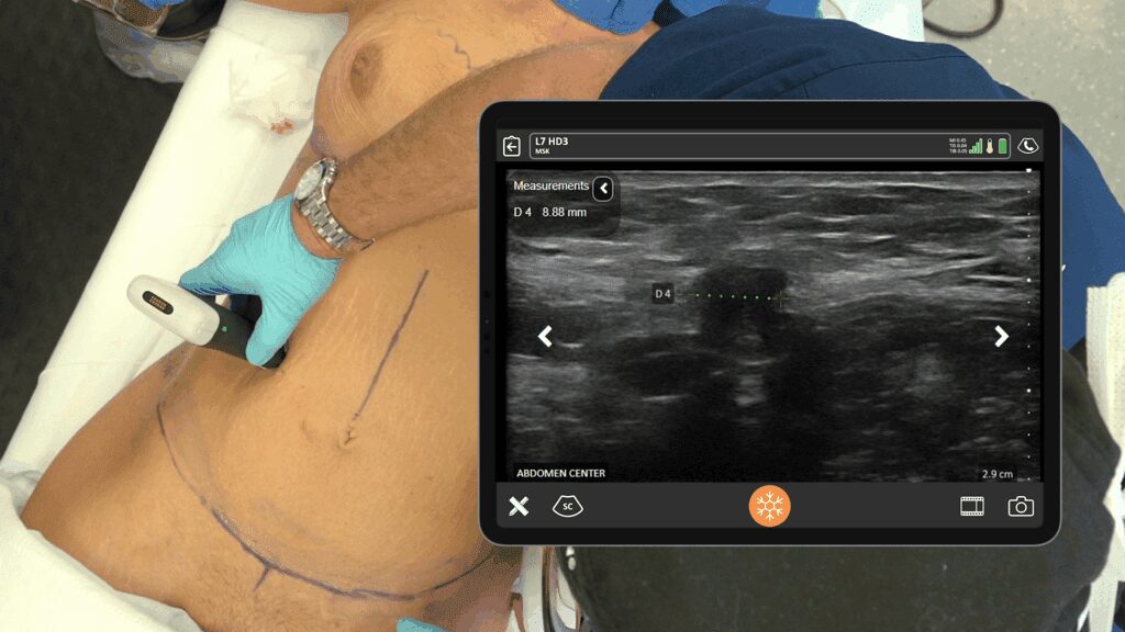 Plastic Surgery | Clarius