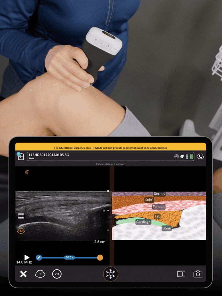 POCUS: Point of Care Ultrasound for Primary Care | Clarius