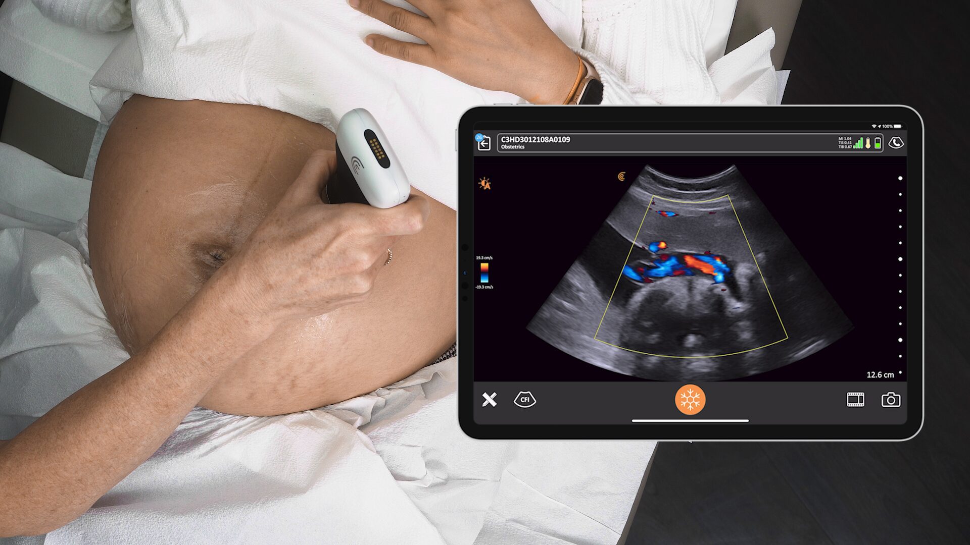 Clarius Research Platform | Portable Ultrasound for Advanced R&D