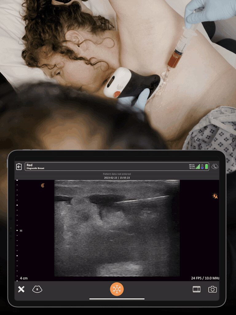 Plastic Surgery | Clarius