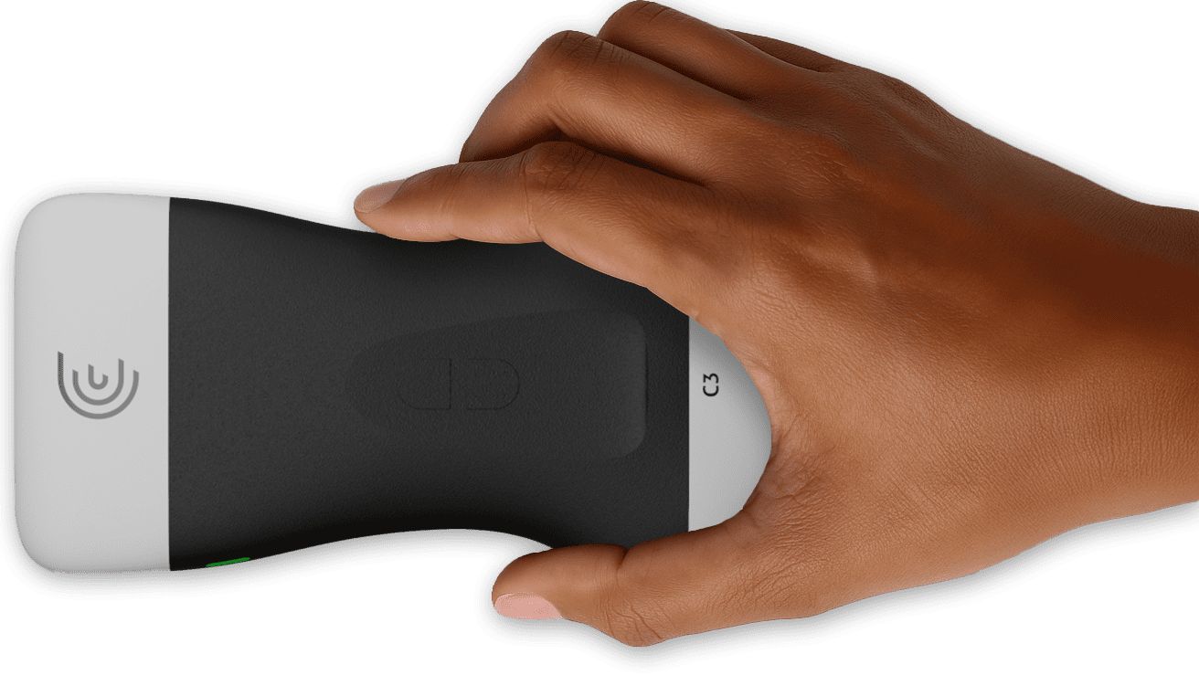 Clarius Mobile Health | Portable Handheld Ultrasound Systems