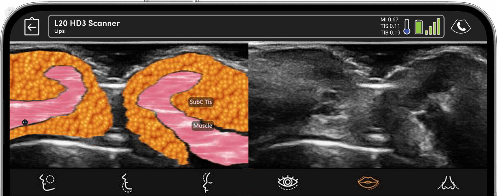 Clarius Intelligence | Clarius