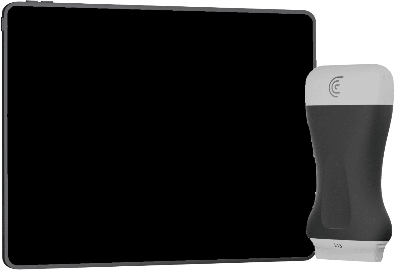 Clarius Mobile Health | Portable Handheld Ultrasound Systems