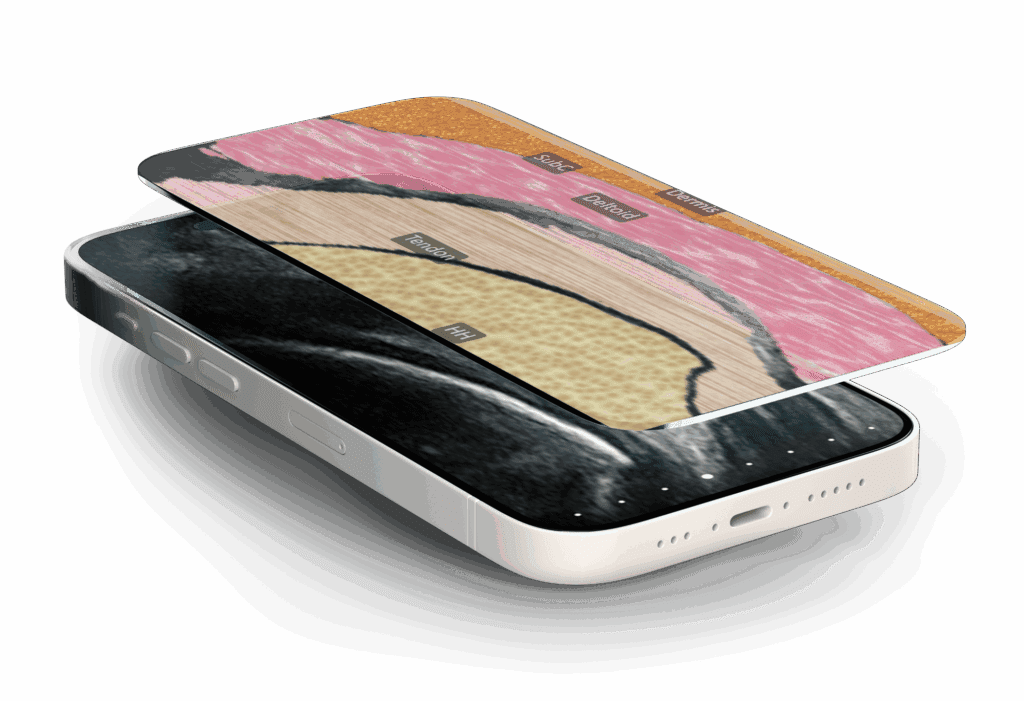 Linear Scanner | Clarius