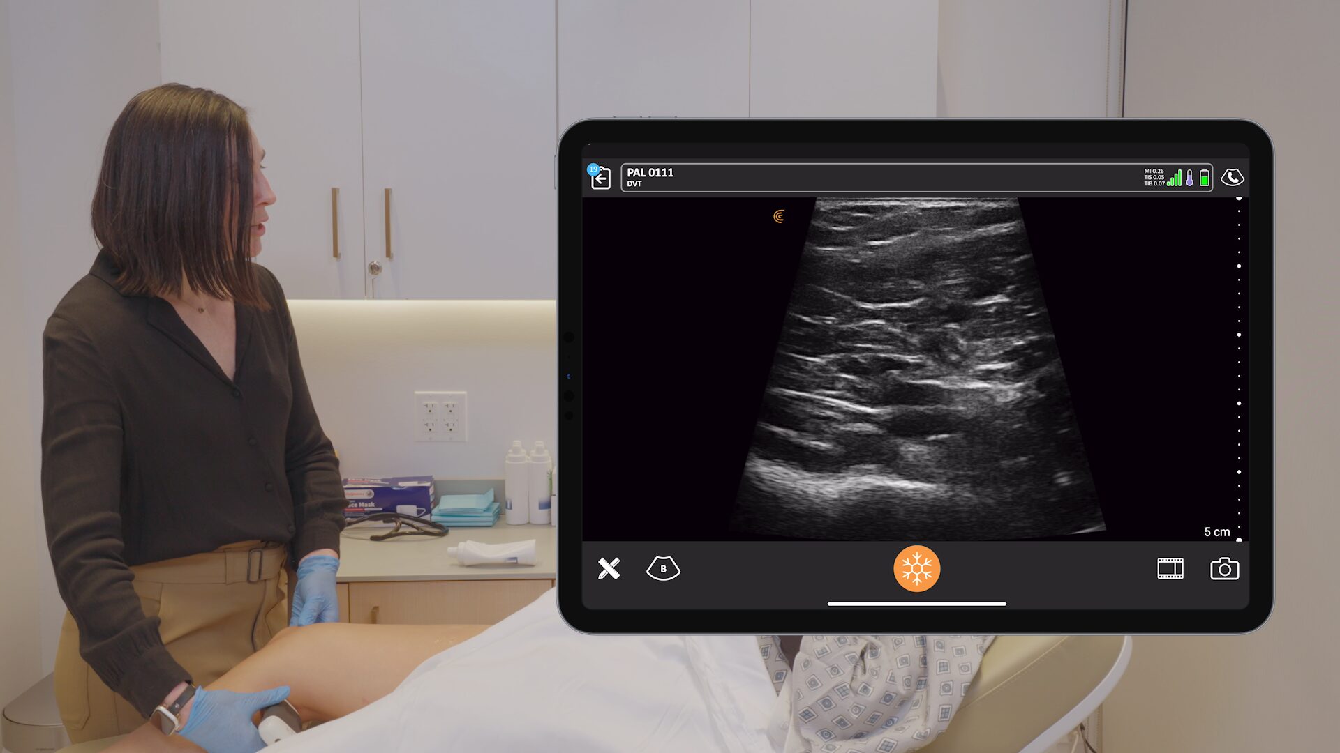 Lower Extremity DVT Ultrasound | Clarius