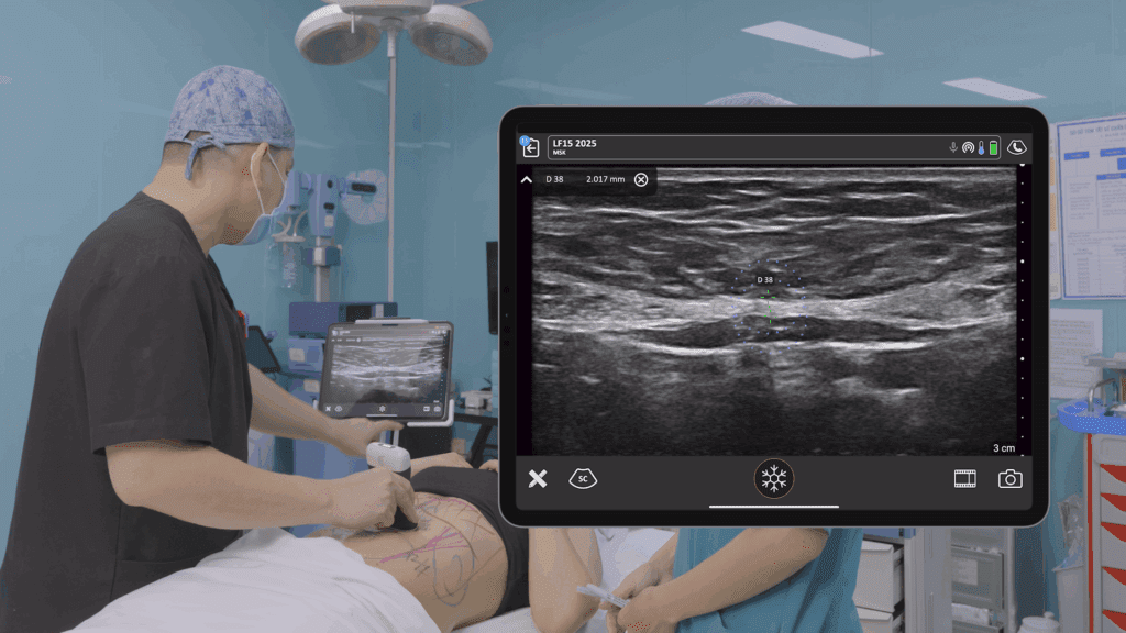 Unmasking Diastasis Recti: How Ultrasound Reveals What Physical Exams ...