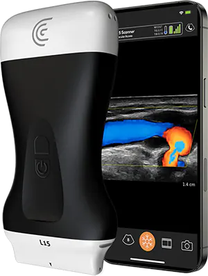 Clarius HD Portable Ultrasound Machine | Clarius